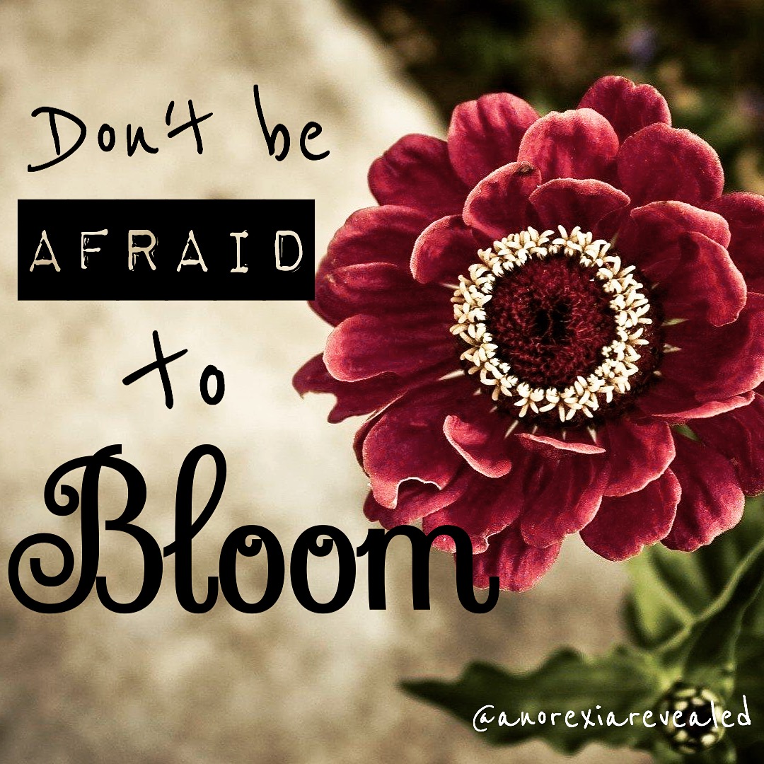 The Importance of Joy – BeautyBeyondBones